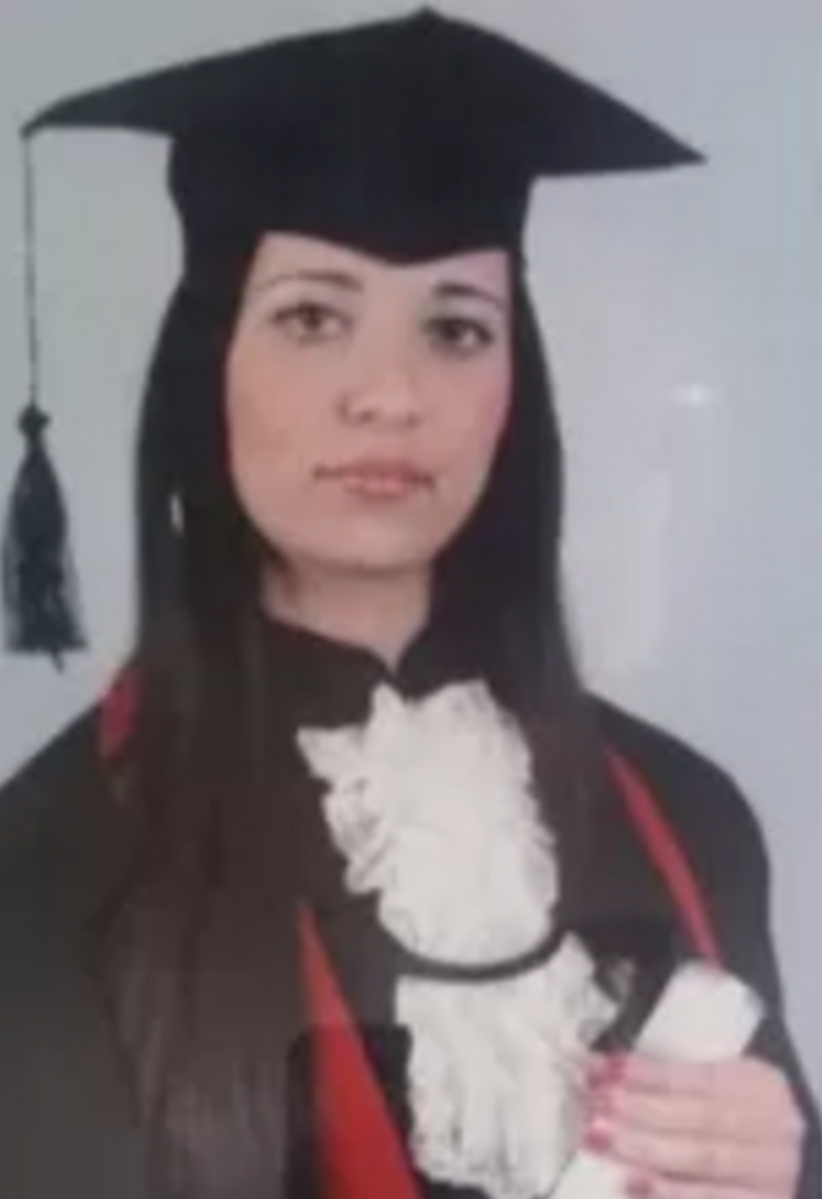 Aos 23, ‘Susi Humana’ já passou por 8 cirurgias; veja antes e depois