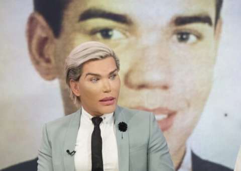 'Ken Humano' brasileiro mostra resultado de novas cirurgias plásticas